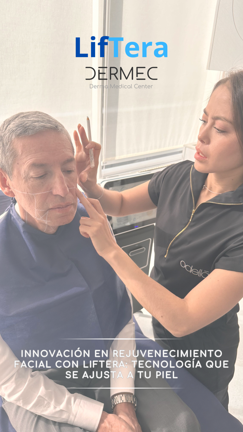 Servicios Principales de DERMEC